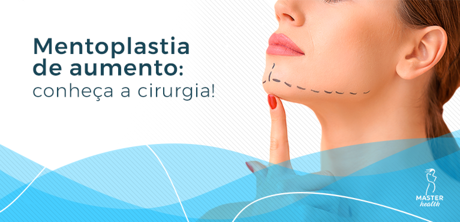 Mentoplastia de aumento e projeção do queixo - Blog Master Health