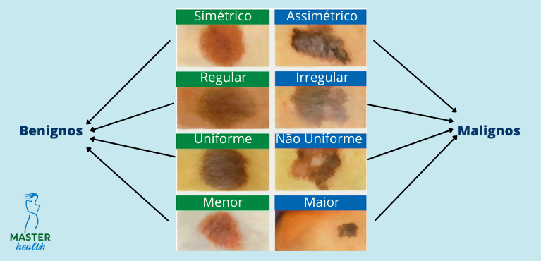 Tipos de pintas: Entenda quais existem - Blog Master Health