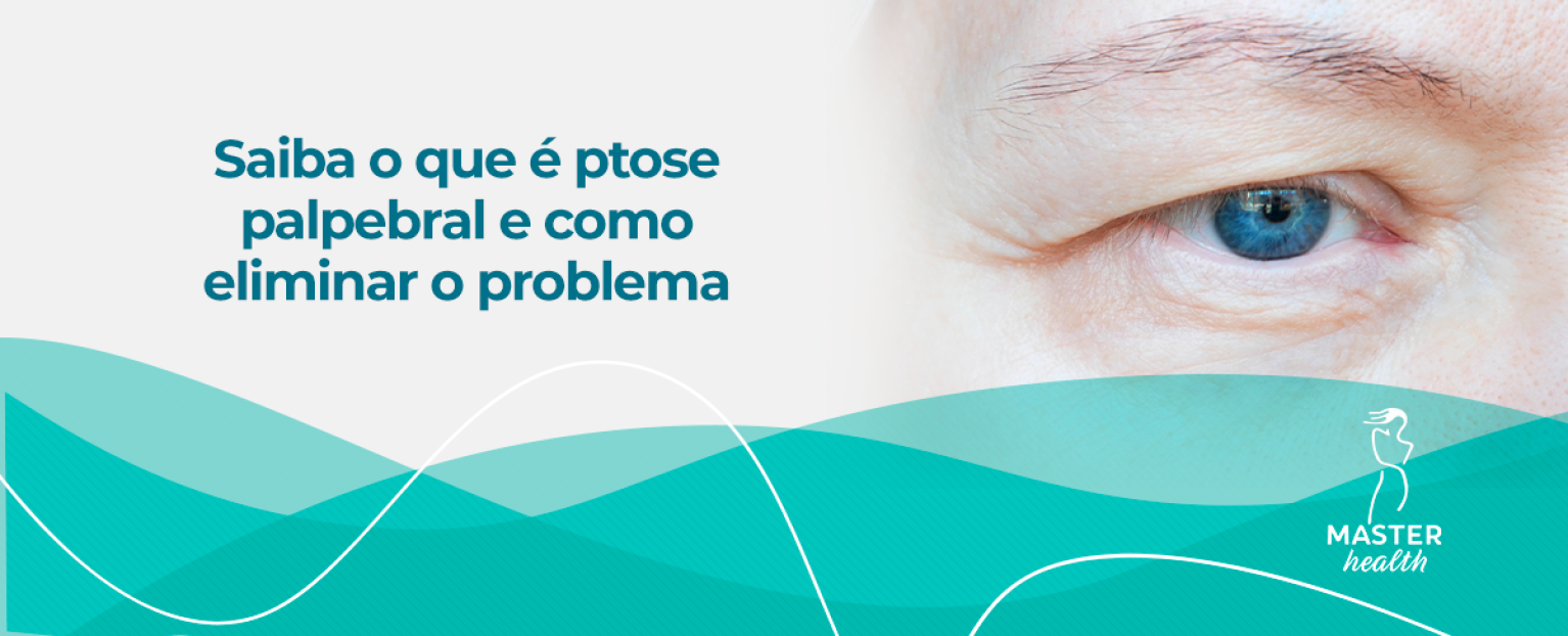 Ptose palpebral: o que é e como corrigir? - Blog Master Health