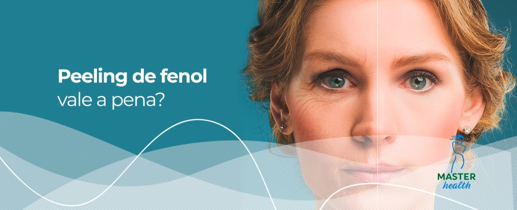 Posts com a Tag peeling - Blog Master Health