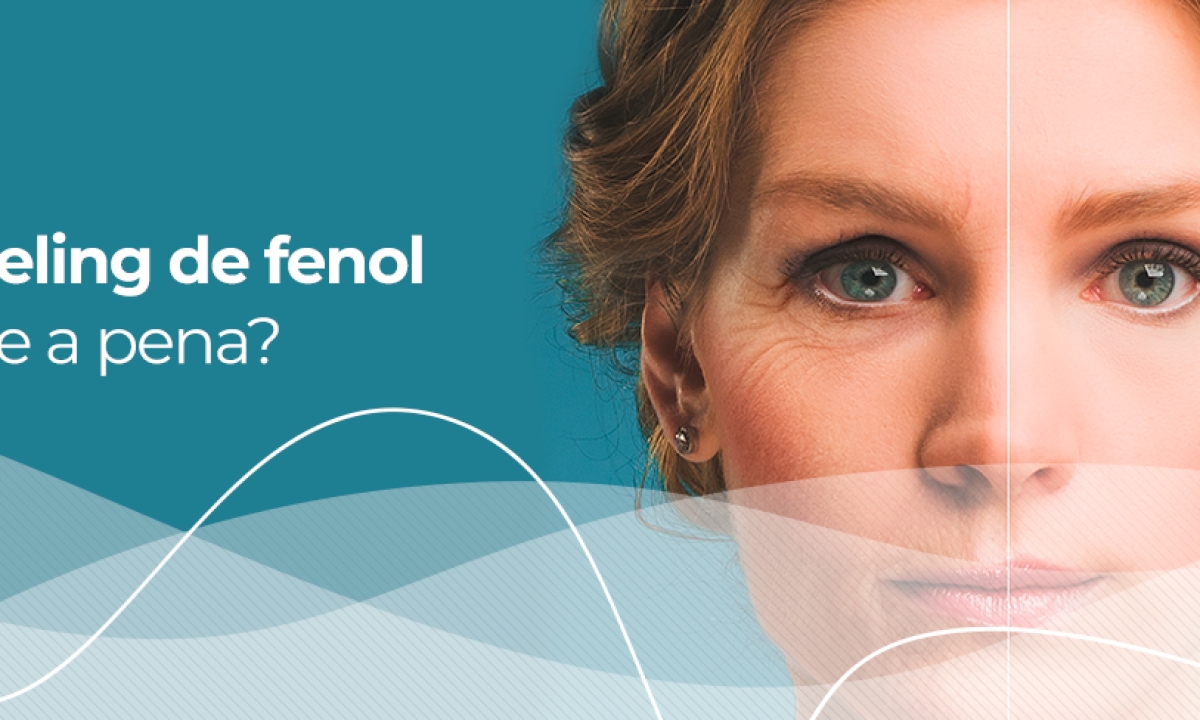Queimadura De Fenol