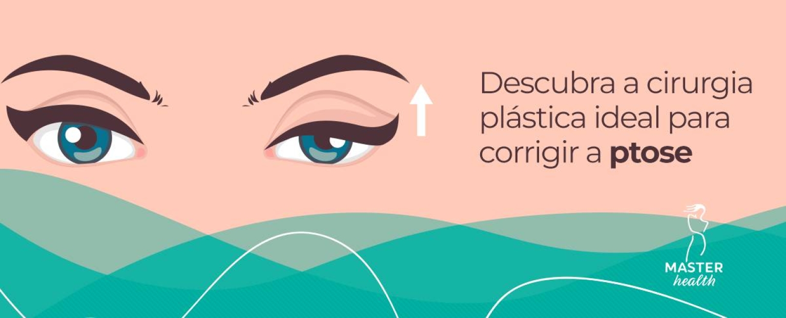 Ptose: o que é e como corrigir o problema? - Blog Master Health